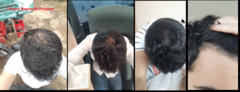 RRF Workbook - Hair Regrowth With Alex